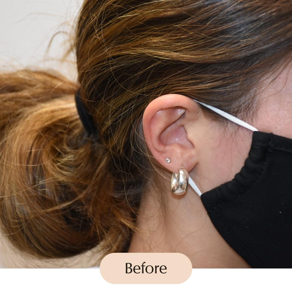 Ear Piercing | bergenderm
